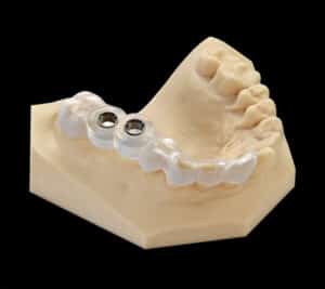 Desktop Health Medical and Dental 3D Printing Solutions