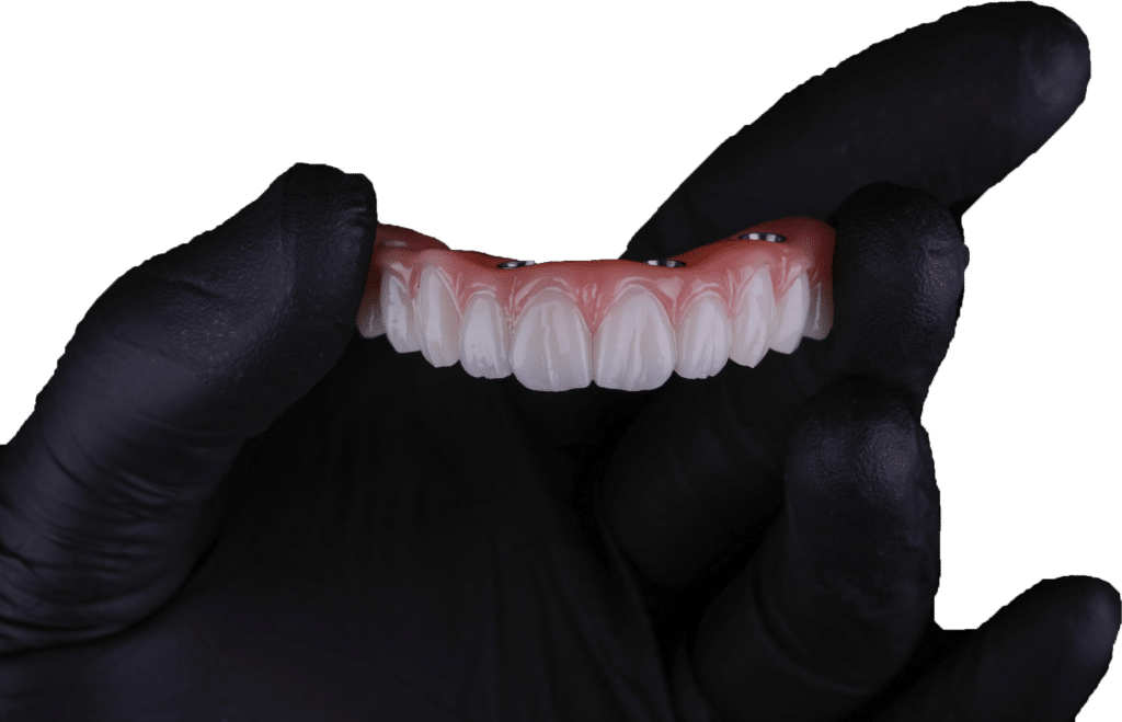 Flexcera® the NEW 3D Printing Dental Resin